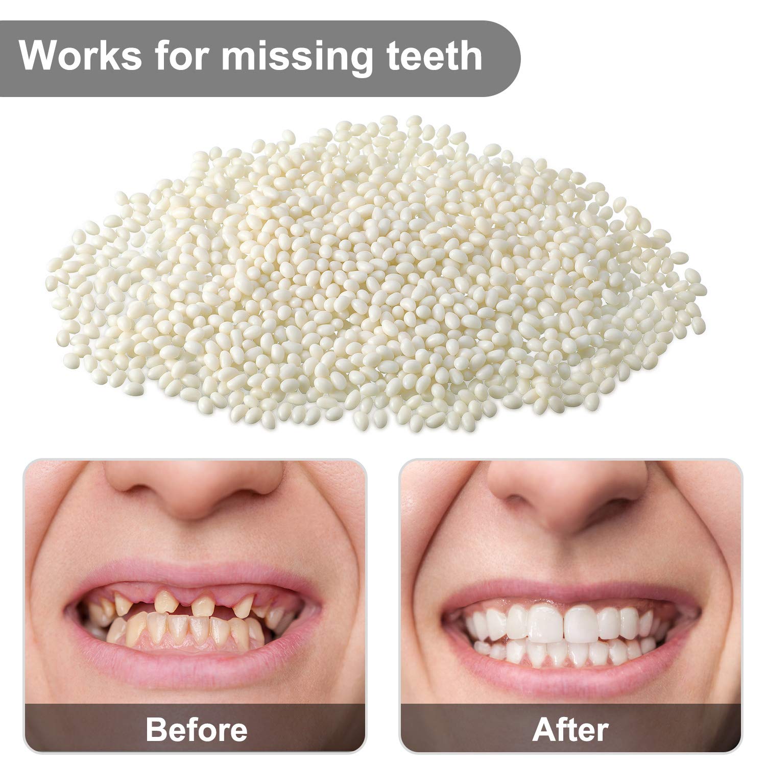 100g Tooth Solid Gel Temporary Repair Kit Moldable Thermal Fitting Bead Teeth Pellet Adhesive Fake Teeth for Halloween Scary Themed Party Makeup Filling Fix the Missing Broken Tooth