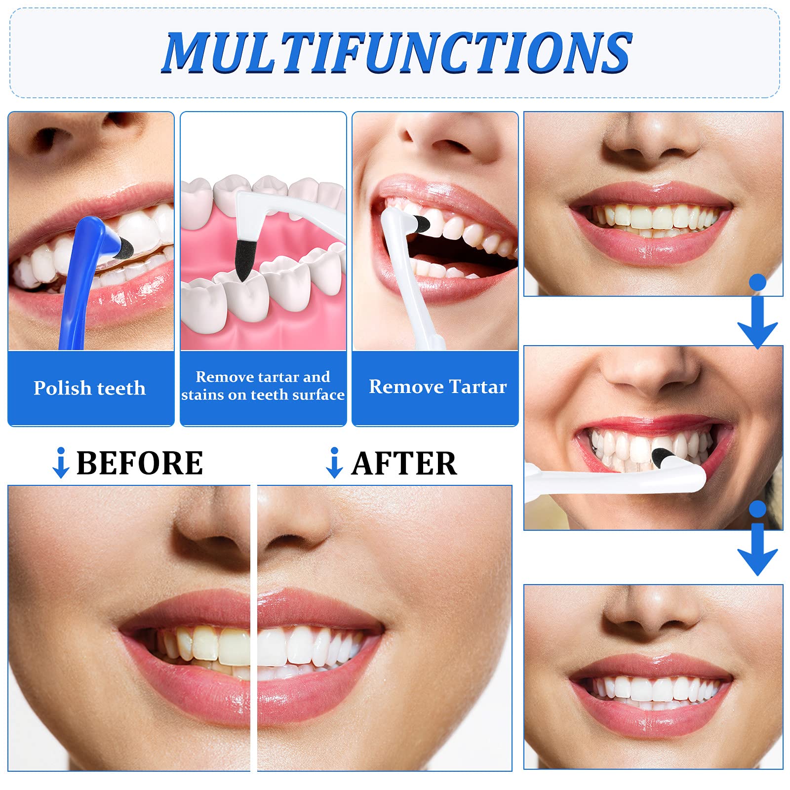 8 Pieces Tooth Stain Eraser Tooth Stain Removers Tartar Eraser Polisher Dental Plaque Tool Teeth Cleaning Kit for Teeth Whitening Polishing