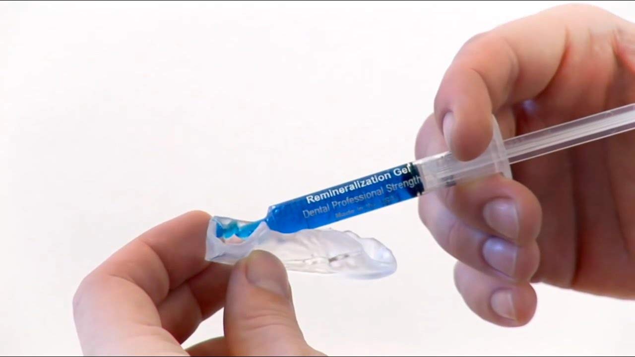 4 Syringes Remineralization Gel with 4 Custom Teeth Trays - Strengthens Teeth Enamel - Reduces Teeth Sensitivity - Remineralizes and Desensitizes Teeth - Great for After Teeth Whitening