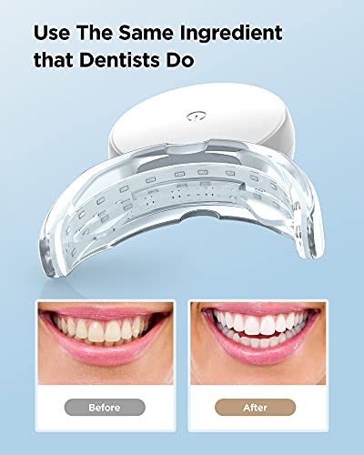 Teeth Whitening Strips with Light, 28 Dentist-Level White Strips for Teeth Whitening, Rechargeable 24X Blue Teeth Whitening Light, Teeth Whitening Kit with Led Light
