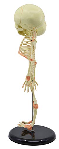 Infant Fetus Skeleton Model, Mini Size - Twin, Conjoined Skull - Rod Mounted - Incredible Detail for Anatomical Study - Eisco Labs