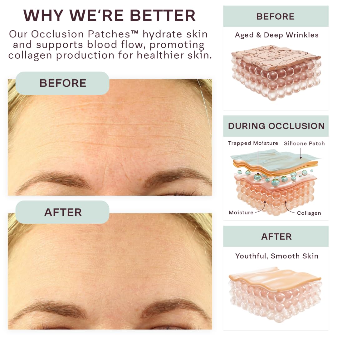 Dermaclara Forehead Patch - Forehead Wrinkle Patches for Face Overnight, Silicone Patches, Reusable Treatment for Wrinkles, Repair & Restore, Up to 30 Uses - 1 Patch