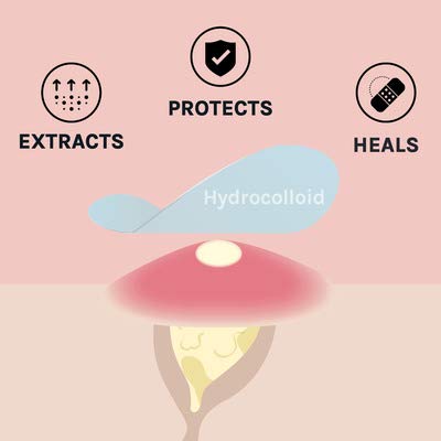 AOA STUDIO Absorbing Cover Healing Invisible Acne Patch Blemish Spot, Treatment, Facial Acne Patch Vegan, Cruelty Free, Hydrocolloid, Two Sizes 10mm 12mm (Total 84 Counts)