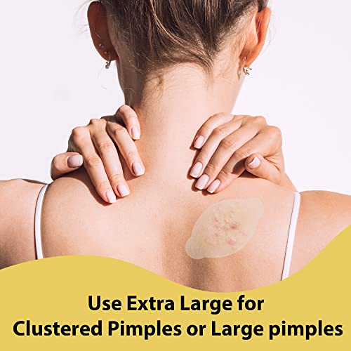 HARUTO Acne Pimple Patches XL (10 patches/1 pack) - Hydrocolloid Large acne Patches Spot Treatment, Tea tree spot patch, acne sticker for Body and Larger Breakouts,