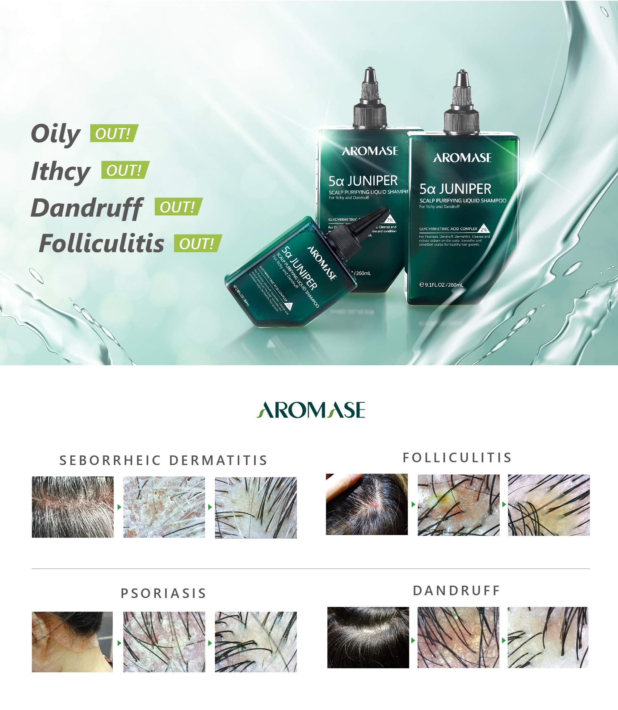 Aromase 5α Intensive Oily Hair Solution Kit (5α Juniper Scalp Purifying Liquid Shampoo 2.8 Fl Oz + 5α Intensive Oily Hair Balancing Essential Shampoo 14 Fl. Oz) for Oily Scalp, Oil Smells