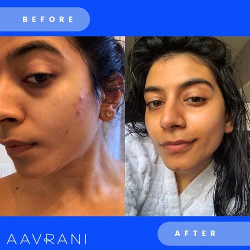 AAVRANI Glow Activating Exfoliator – Stain-Free Turmeric Face Mask with Raw Honey, JoJoba, and Neem – Exfoliating Clay Mask for Acne, Dark Spots, and Deep Pore Cleansing (1.0 Fl Oz)