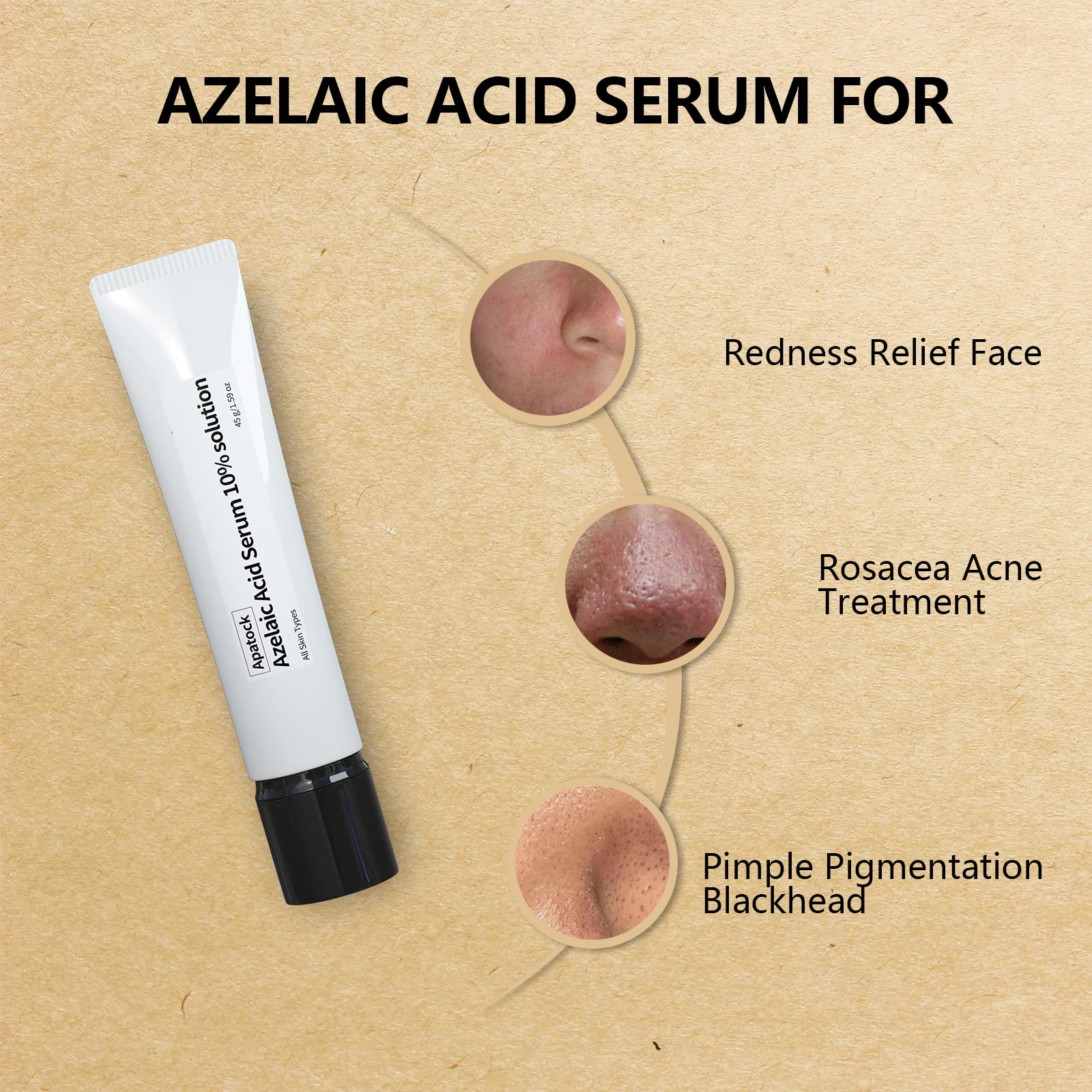 10% Azelaic Acid Serum Solution Apatock,Rosacea Treatment for Face,Dark Spot Remover,Redness Relief for Face,Natural Extracts Gently Acne Treating (1.4 oz(Pack of 1))