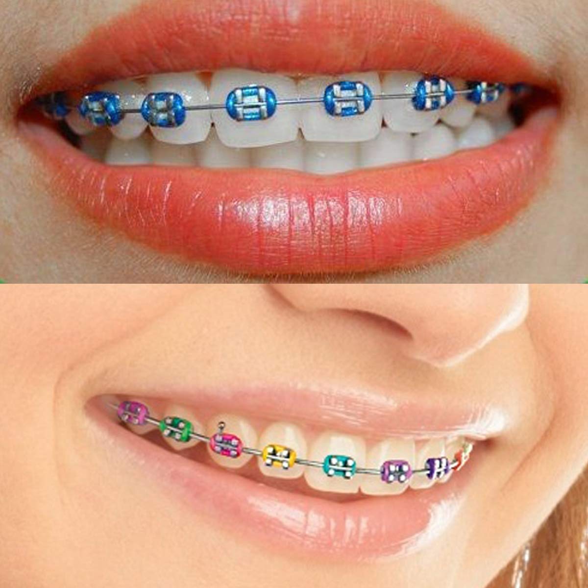 Dental Orthodontic Ligature Ties and Orthodontic Ligature Gun Tools Teeth Orthodontic Ligature Ring Rubber Bands Multi-Color(1040 Pcs/Bag)