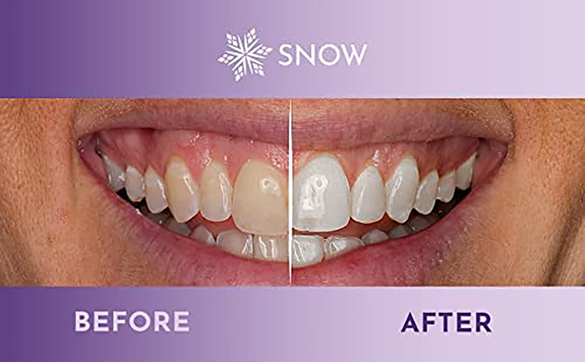 Snow The Magic Strips - Safe for Enamel Dissolving Teeth Whitening Strips - Mess-Free Portable Teeth Whitener for Oral Care with Lavender & Mint Flavor, Whitening Strips for Teeth, 1 Pack of 28 Strips