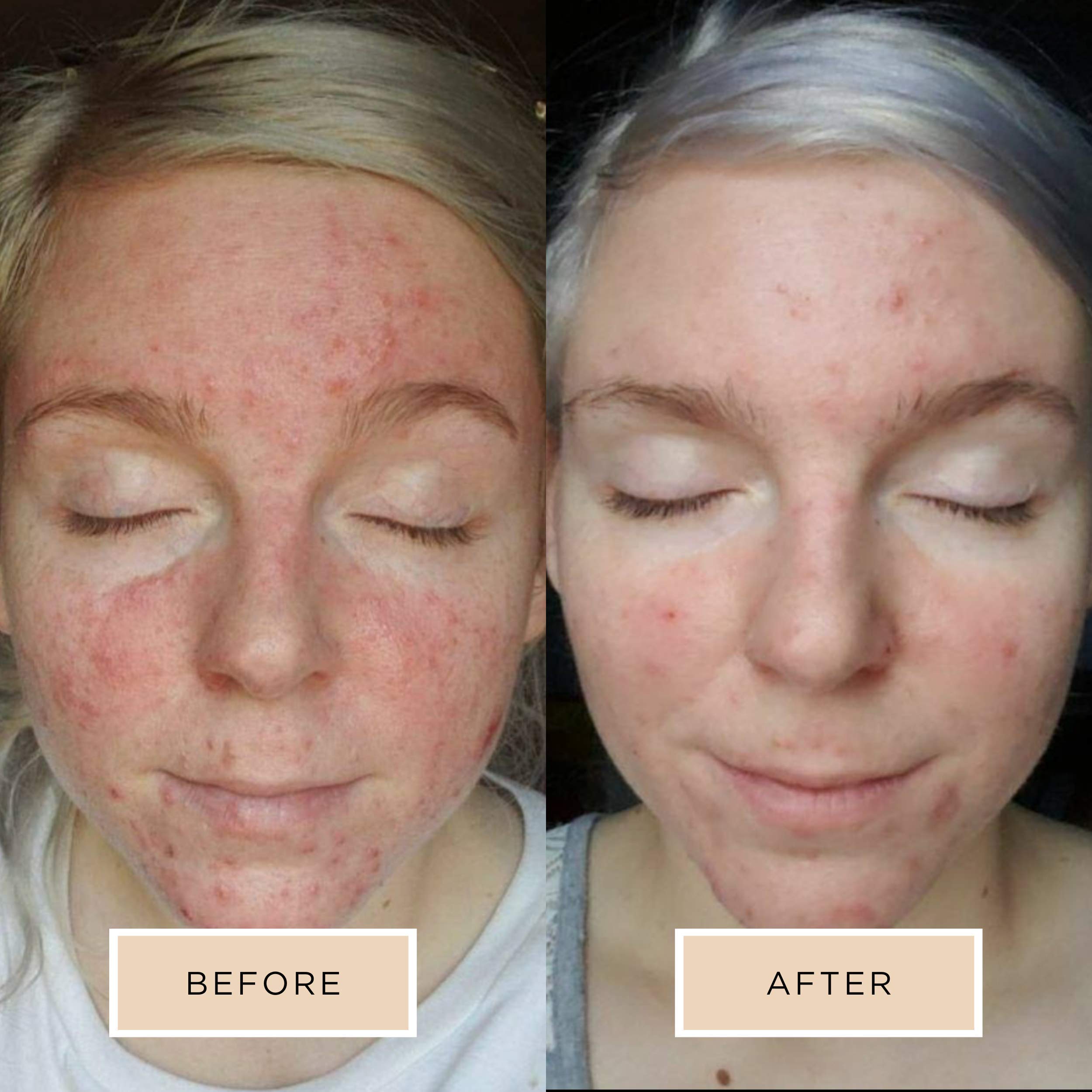 Averr Aglow Luminous Complexion Toner, Face Skincare, Reduce Blackheads Breakouts & Dark Circles, Natural Solution Moisturizing Facial Toner, Hydrating & Soothing Effect