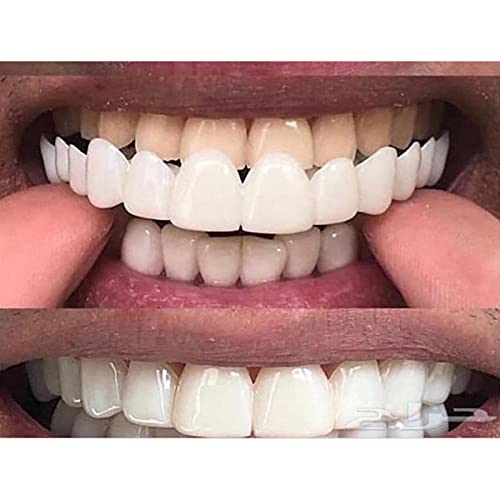 New Snap Smile Dental Upper False Teeth Cover Perfect Smile Veneers Comfort Fit Flex Denture Braces