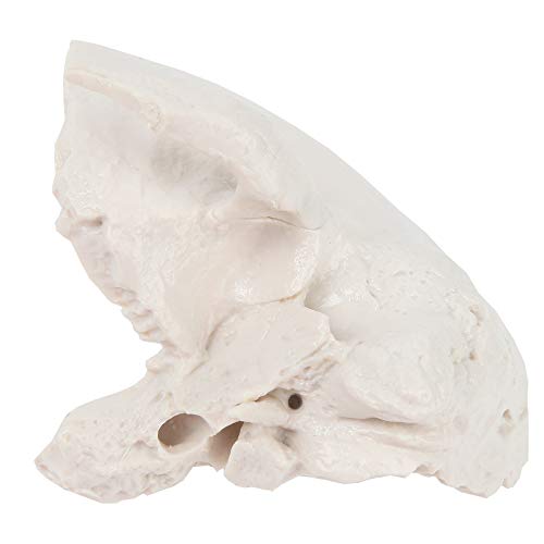Axis Scientific Temporal Bone - Left
