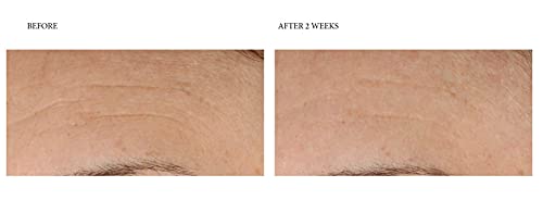 Dr Dennis Gross B³Adaptive SuperFoods™ Stress Repair Face Cream. For Dehydration, Redness, and Worry Lines, 2.0 fl oz