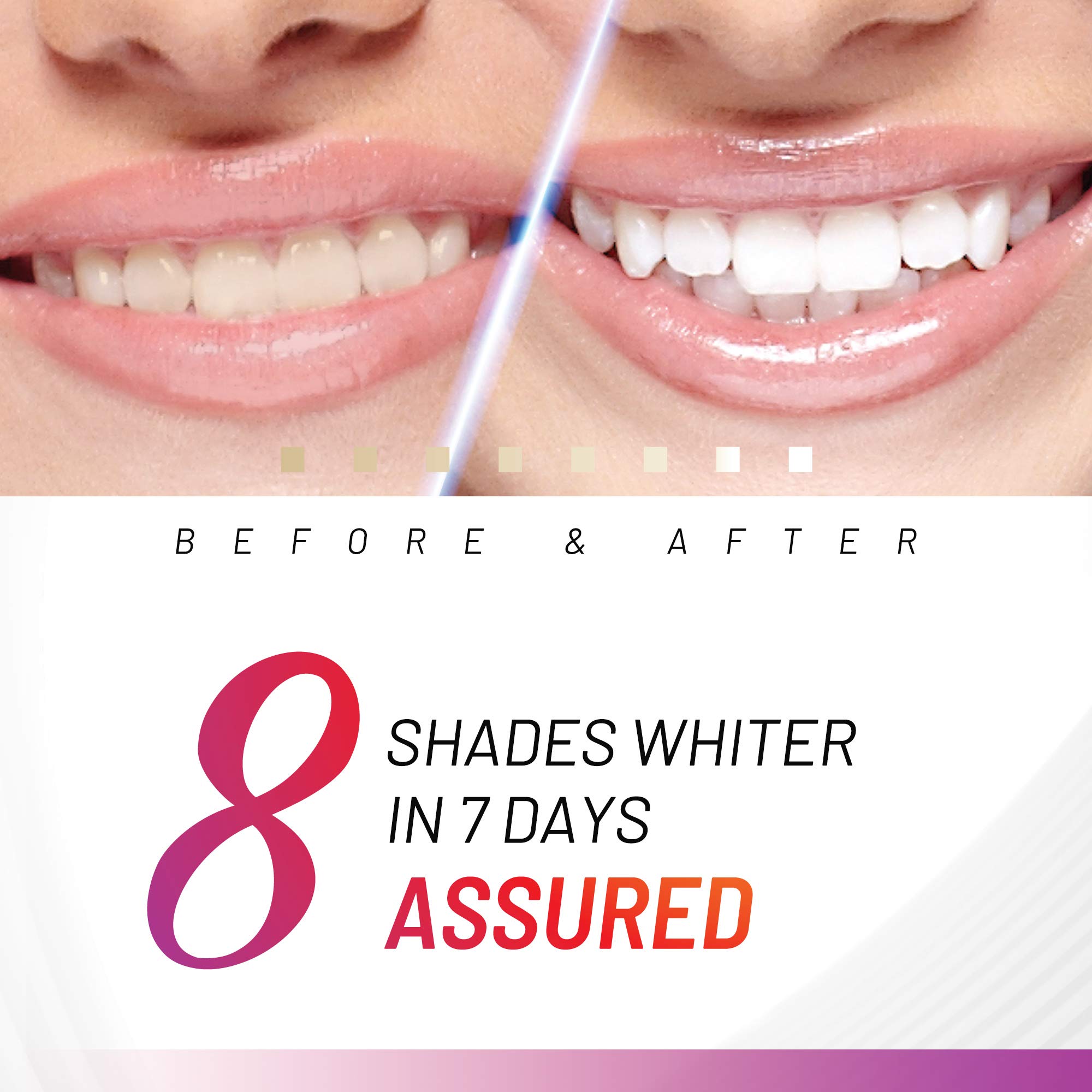 White Glo Accelerator Teeth Whitening Refill Gel for Sensitive Teeth and Gums, 3 Months of Professional Treatment, Carbamide Peroxide, Papaya, Pineapple Enzyme for Best Teeth Whitening Results - 3.4oz