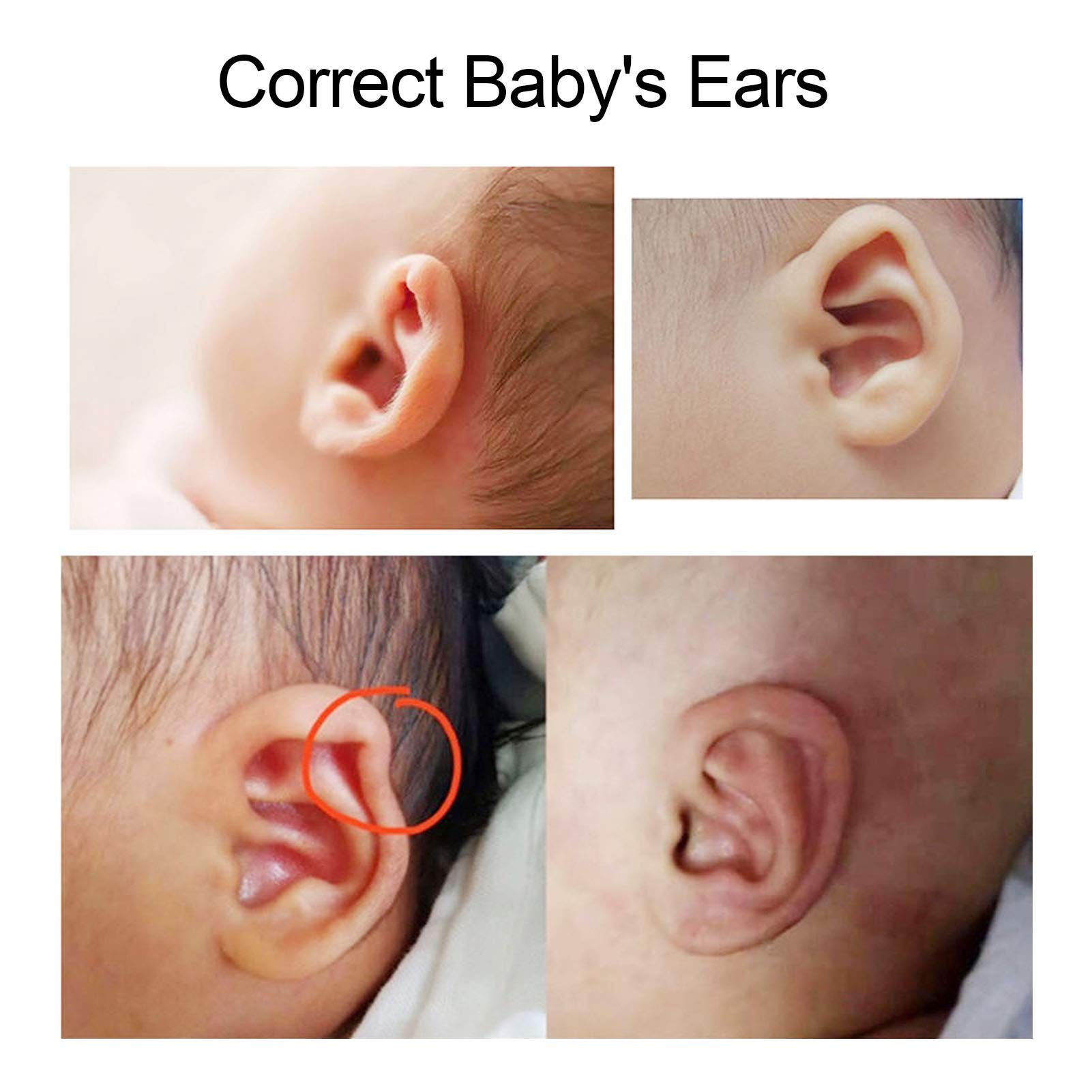 4 x 50cm Silicone Newborn Baby Ear Aesthetic Correctors, Kids Infant Protruding Ear Patch Stickers