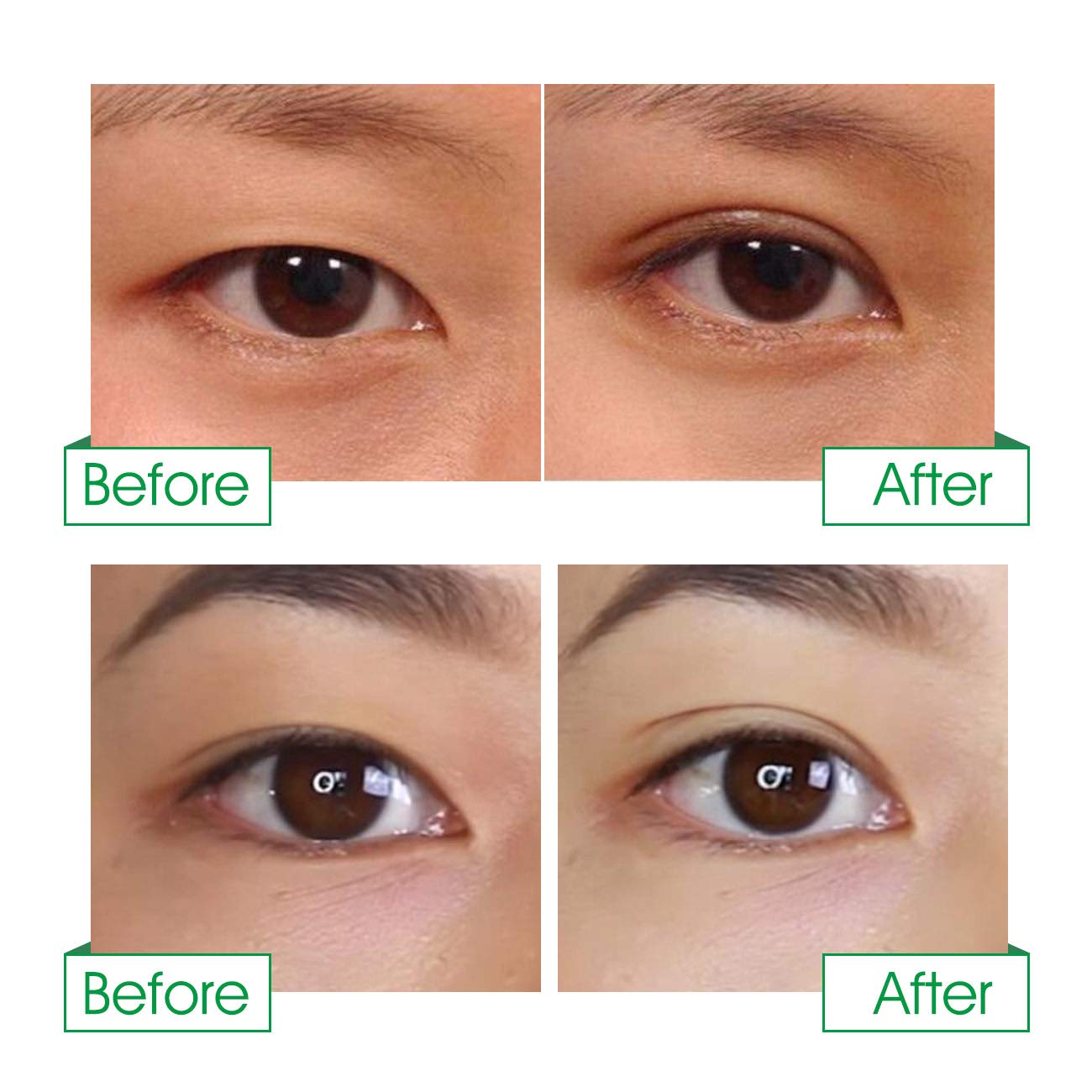 2Bags/656Pcs Invisible Slim Double Eyelid Tapes Lift Strips Stickers, One-sided Sticky, Instant Eyelids Lift, Suitable for Saggy, Hooded, Droopy, Uneven, Mono-eyelids