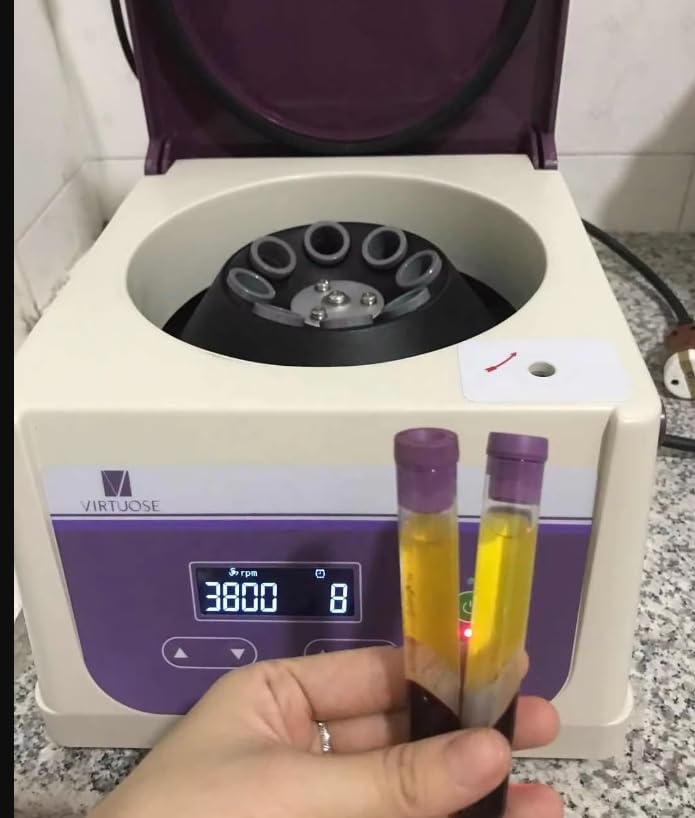 24 Tubes 12ML PRP Tubes for Platelet Rich Plasma Pyrogen Free and High Quality