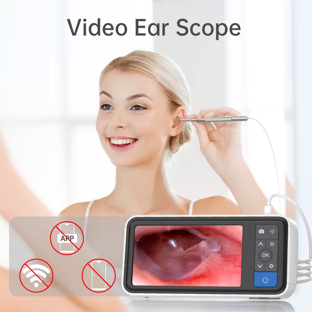 3.5mm Digital Otoscope Camera with Light, Visual Ear Camera and Ear Wax Tweezers with Light, Video Ear Scope with Ear Wax Remover, Ear Endoscope Cleaner, 32GB, 1080P HD, No Phone Needed