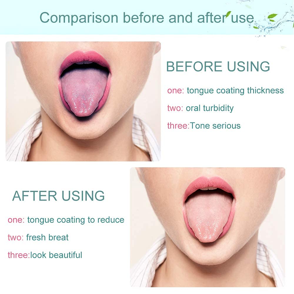 6 Pack Tongue Scraper for Adults,Tongue Cleaner,Tounge Scraper Cleaner,Tongue Brush, Fresh Breath Tongue Scraping(Random color)