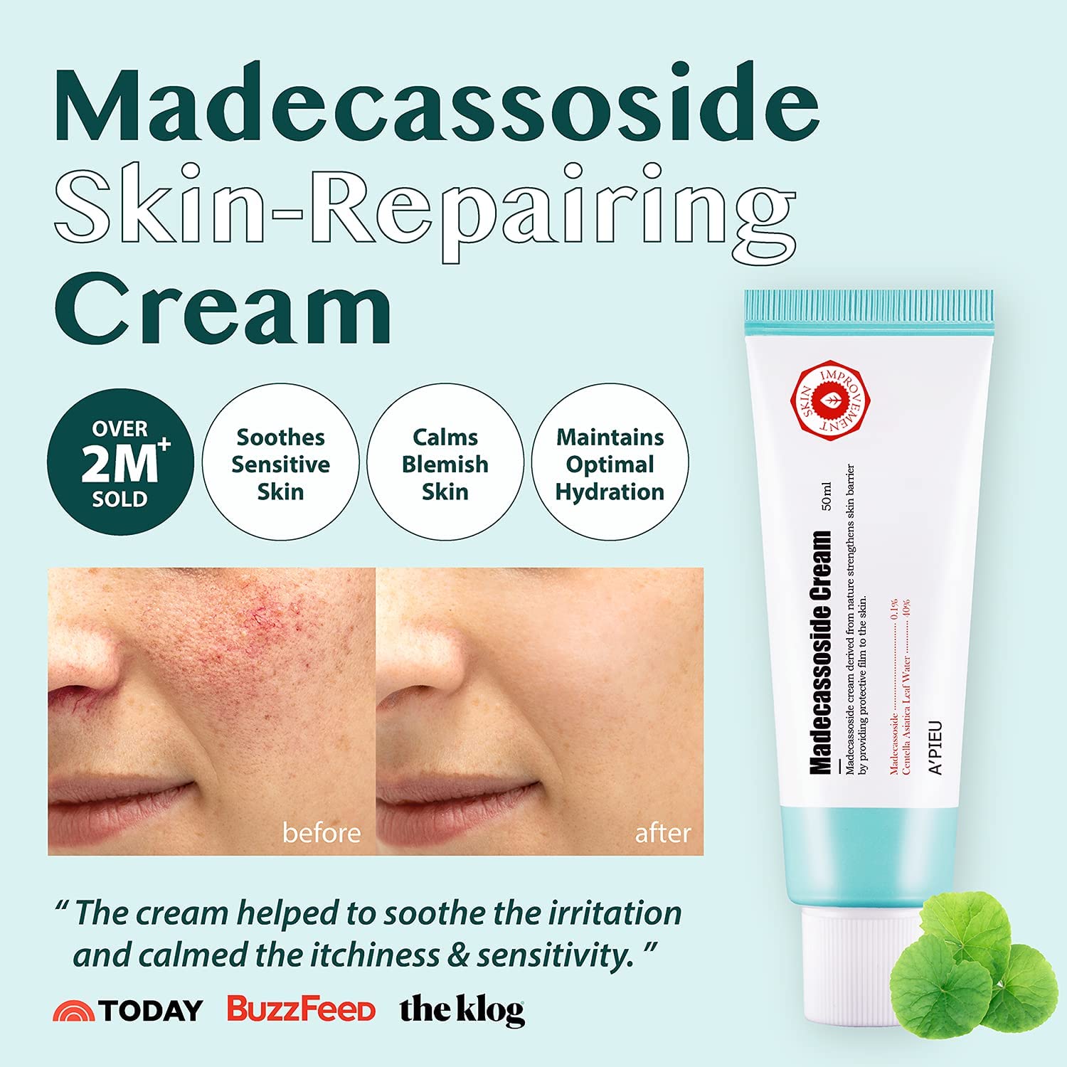 A'PIEU Madecassoside Tetrasome Cica Cream 1.69 fl oz with Centella Asiatica and Niacinamide | Natural Madeca Cream for Intense Hydration and Soothing