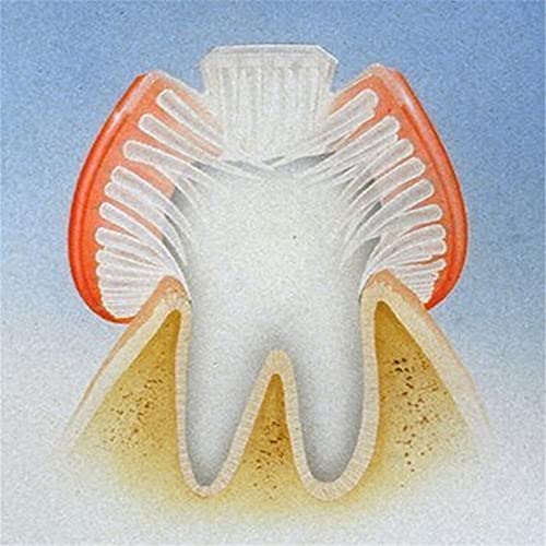 SDFSDFSF Three Side Toothbrush is Used for Tooth Protection, Powerful Cleaning, Removing Tooth Stains, Smoke Stains, Tooth Stones, Three Side Adult Hand Soft Hair (Yellow)
