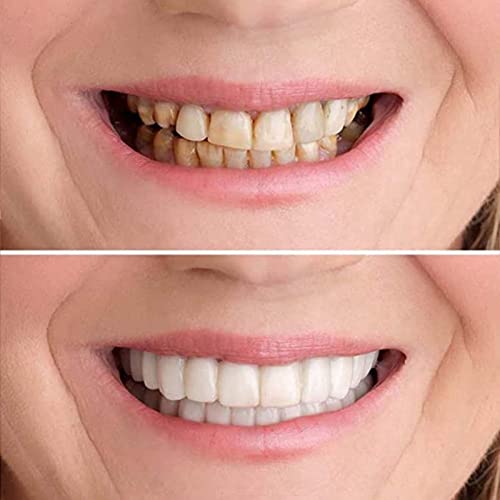 2 Pairs Fake Teeth，Adjustable Veneers Dentures for Men and Women，Cosmetic Tooth Repair Kit for Regain Confident Smile.