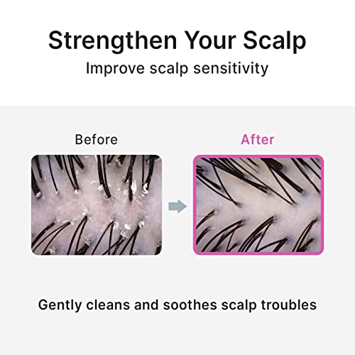 simplyO Refreshing Scalp Shampoo | Biotin & Panthenol I Dry, Itchy Scalp | Paraben-Free, Sulfate-Free I Green Breeze I 10.1 fl. oz