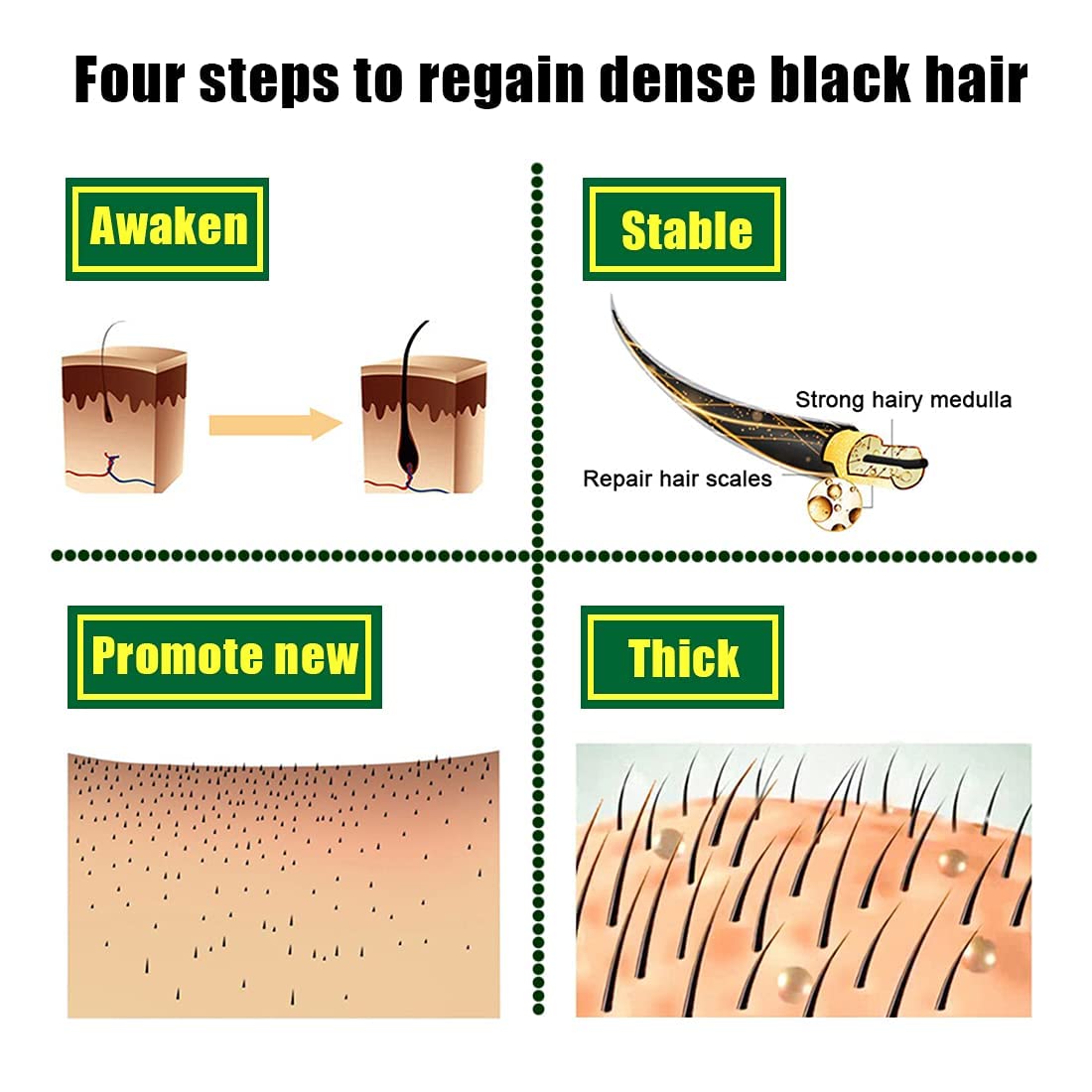 Ginger Hair Growth Germinal Oil, Regrow 7 Days Ginger Germinal Serum for Nourishing Hair Roots, 30ML (3pcs)