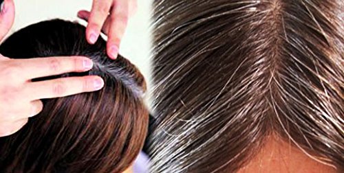 4 ORGANOGAL - NO MORE GREY OR WHITE HAIR NO ROOT PROBLEM GRISI ORGANOGAL SHAMPOO -
