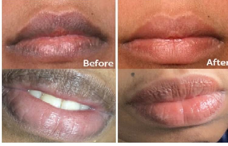2PC Lip care Of Lips Pink Fresh Lightening Bleaching Cream Treatment Remove Dark Smoke Lips lip oil Green 2 Count (Pack of 1)