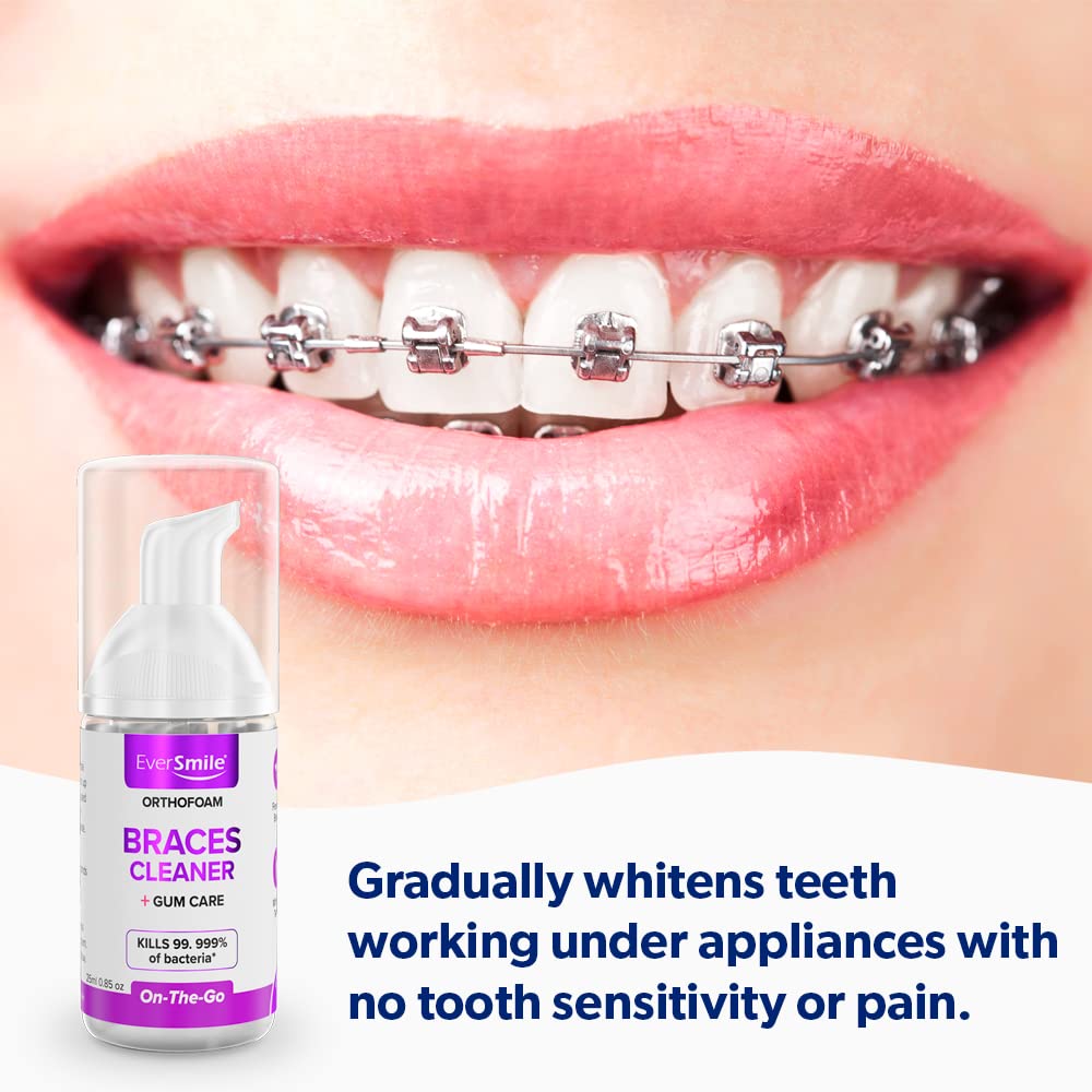 OrthoFoam Braces Cleaner - Cleans Under Metal, Ceramic or Clear Brackets & Wires. Can Brush or Rinse with & Use in Trays. Foaming Bubbles Whiten Teeth & Fight Plaque (1 Pack - 25 ml)