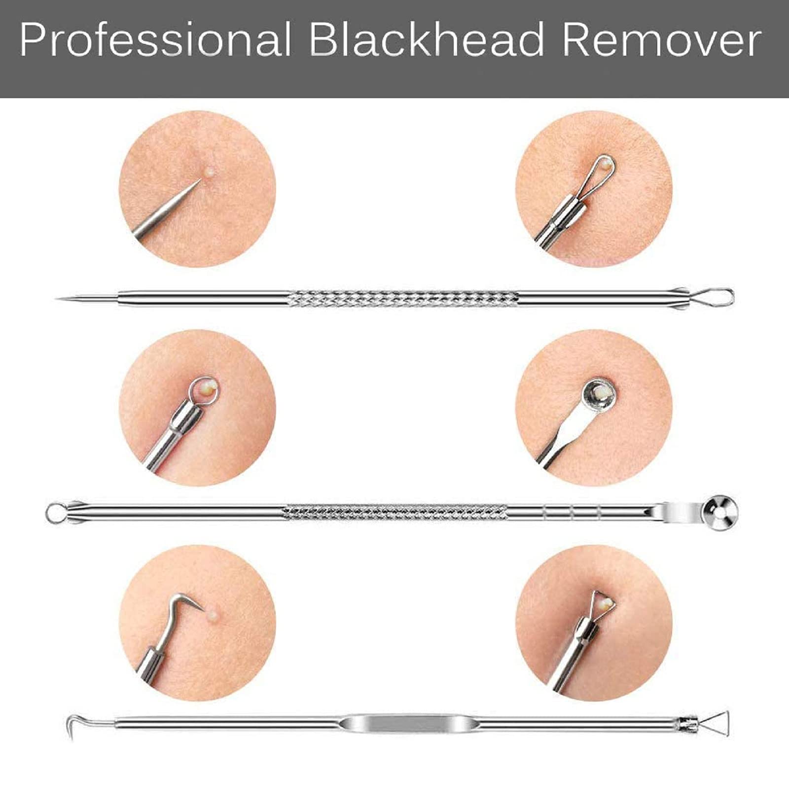 Blackhead Remover Pimple Comedone Extractor Tool Acne Kit - Treatment for Blemish, Whitehead Popping, Zit Removing for Risk Free Nose Face Skin (Sliver)