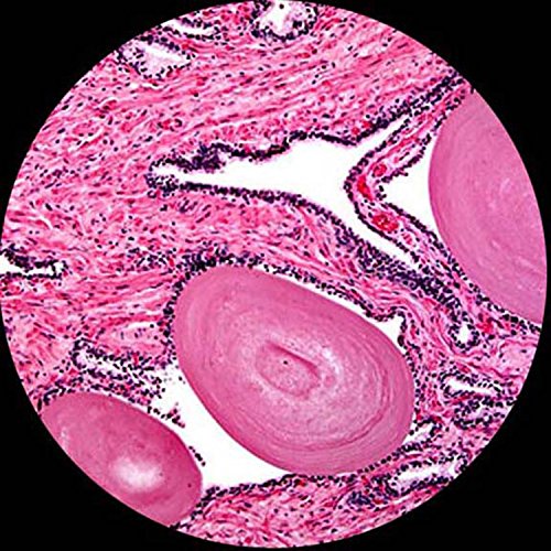AmScope D120-MS Dual-View Compound Monocular Microscope, 40X-1000X Magnification, Brightfield, 1.25 NA Abbe Condenser, Mechanical Stage