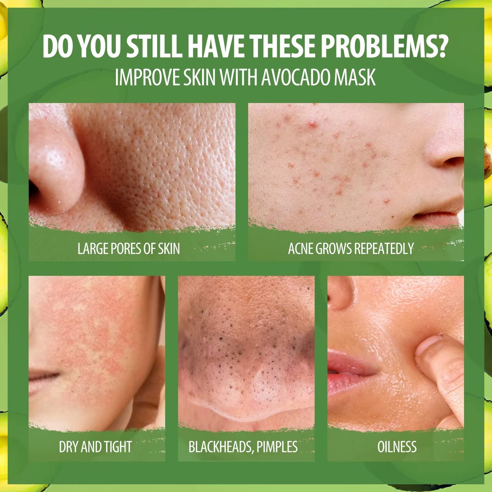 Clay Stick Mask Avocado Dead sea Mud Mask Natural Green Tea Purifying Clay Stick Mask Deep Cleansing Blackhead Remover Clay Mask Nourishing Hydration Facial Mask With Blackhead Remover Extractor Tools