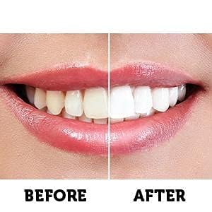 Active Wow 24k White Premium Teeth Whitening Kit - LED Teeth Whitening Kit, Teeth Whitening Light, Fluoride Free, Teeth Whitening Kit with LED Light - Mint Flavor, 30 Treatments