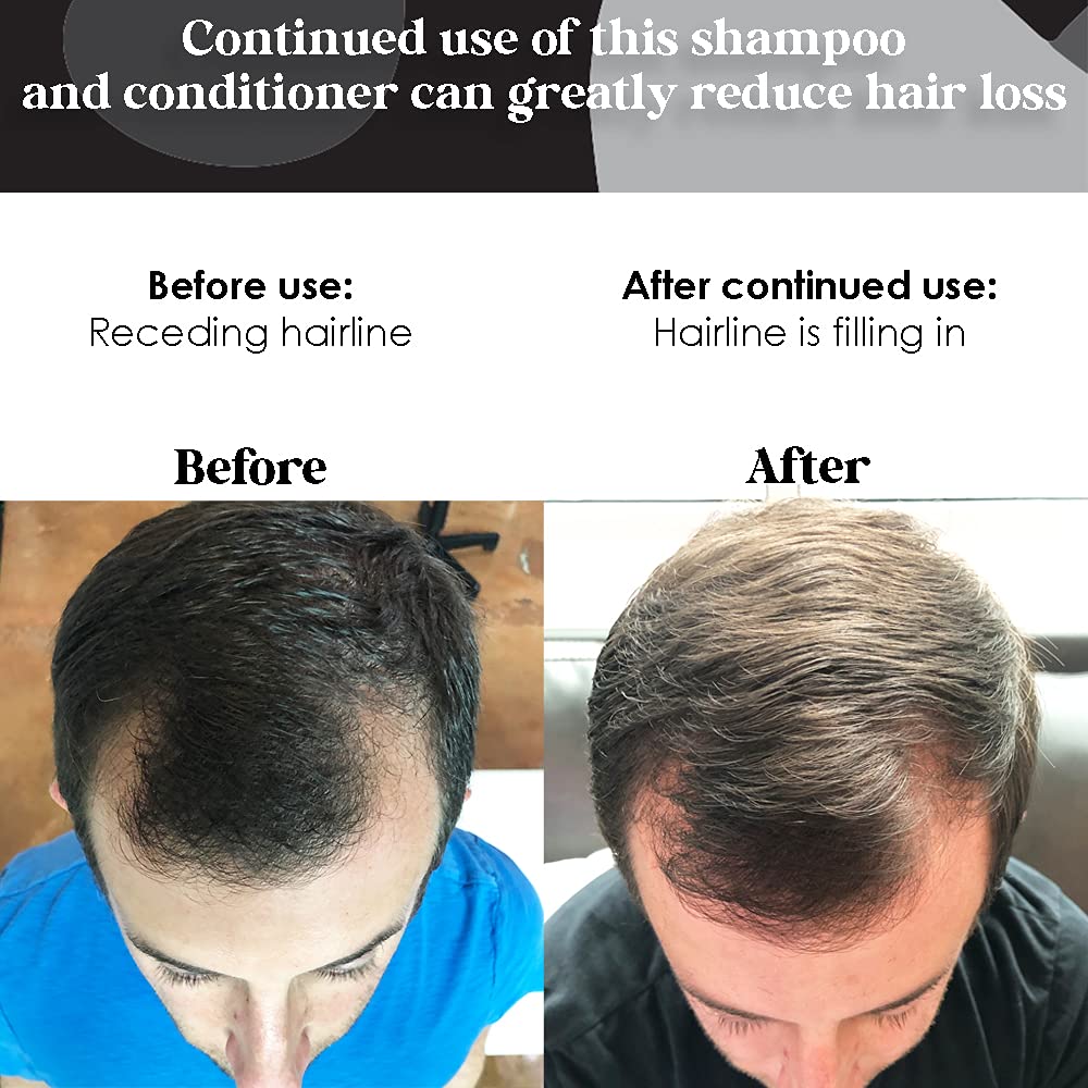 B THE PRODUCT High Potency Biotin Hair Growth Shampoo & Conditioner Set - Fortified with Vitamins E, A, C & B for Fastest Hair Growth (8.5oz.)