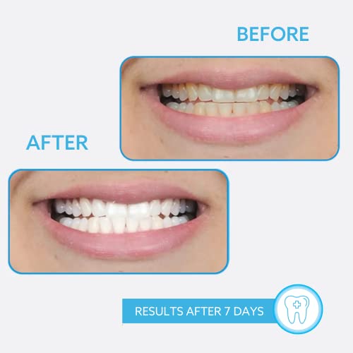 GO SMILE Extreme White Professional Teeth Whitening 7 Day Morning & Night System - Dentist Recommended & Clinically Proven to Whiten in 7 Days with No Sensitivity, 14 Single Use Whitener Applicators