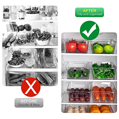 8 pack Refrigerator Organizer Bins, Organizer Bins with Handles, Fridge Organizer for Freezers, Kitchen Countertops and Cabinets, Food Grade BPA-free(Clear)