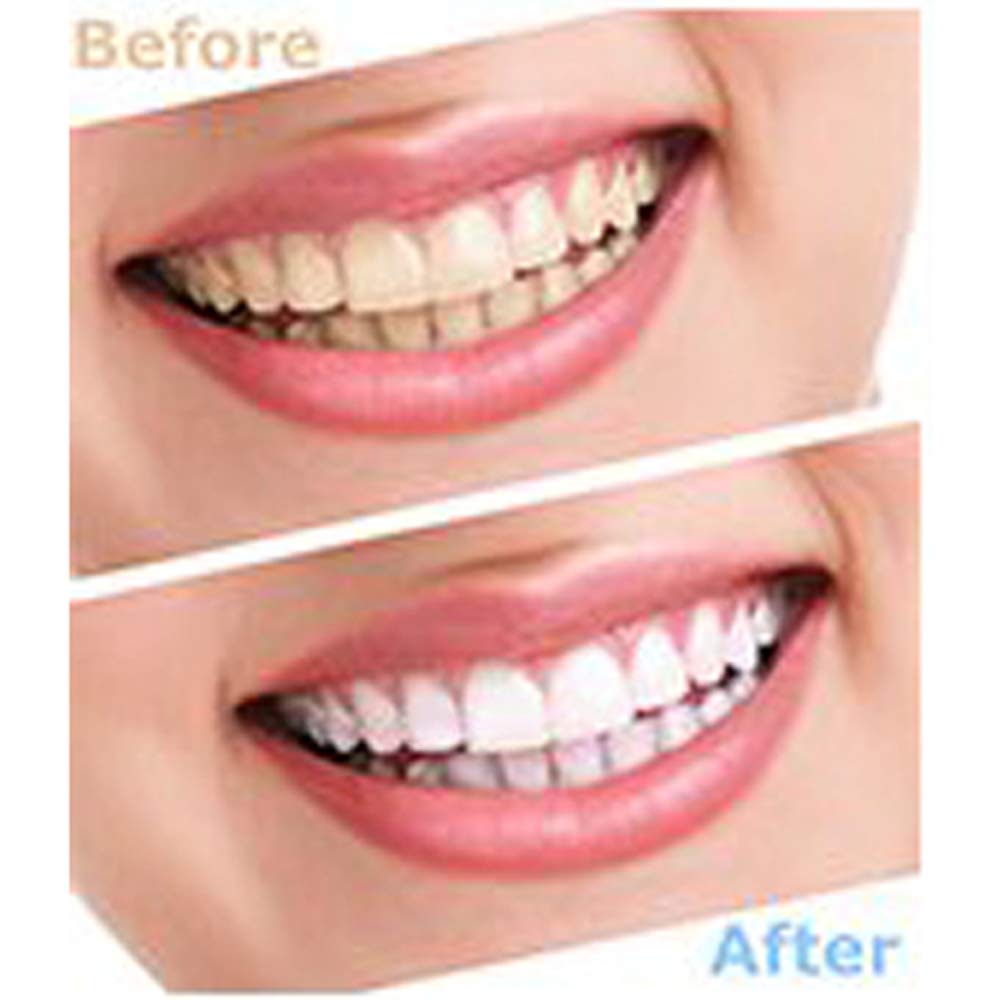 VINFANY 8x Replacement Toothbrush Head for Oral B,Compatible with Braun Electric Rechargeable Toothbrush, for Vitality 3D All 8 Pack.