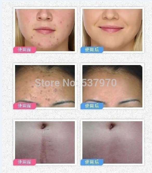 Bepanthen Skin Moisterizer (Moisturizing Cream) 30 Grams