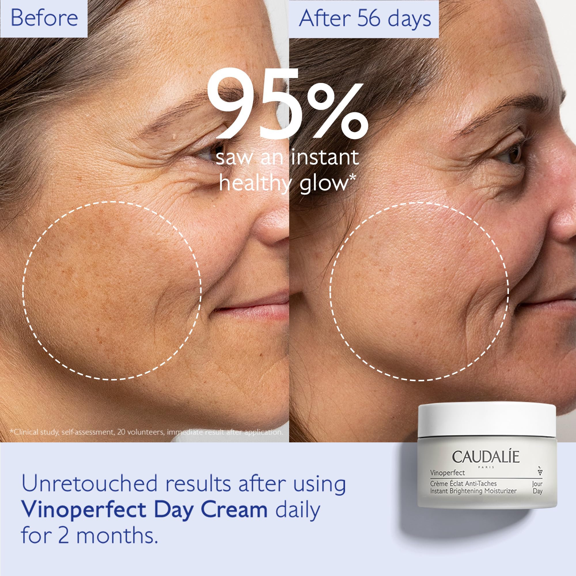 Caudalie Vinoperfect Instant Brightening Dark Spot Moisturizer with Niacinamide - 1.7 Fl. Oz