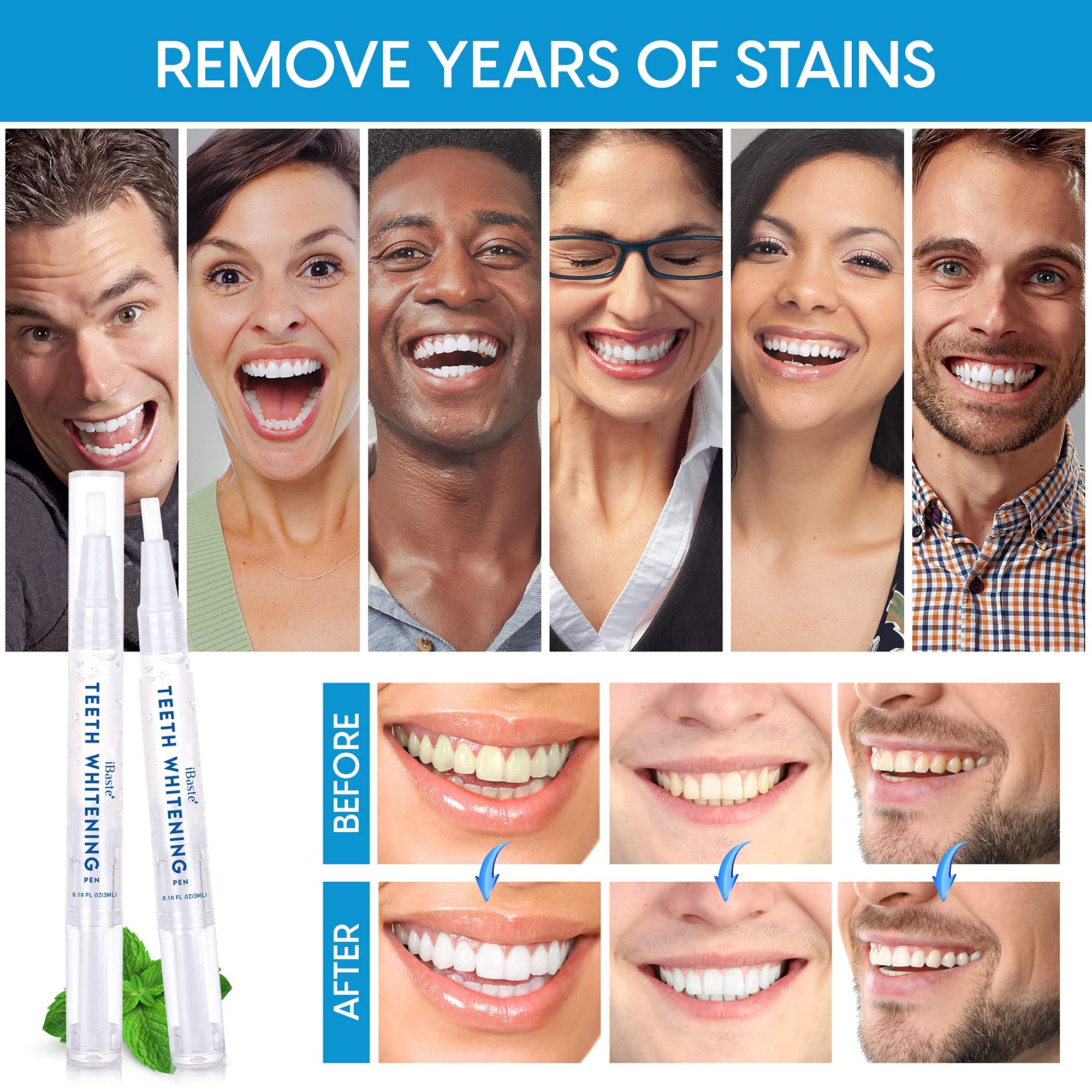 Teeth Whitening Pen - 3 Pens, 35% Carbamide Peroxide, Effective & Painless Whitening, Perfect for Sensitive Teeth, No Sensitivity, Travel-Friendly, Natural Mint Ingredient