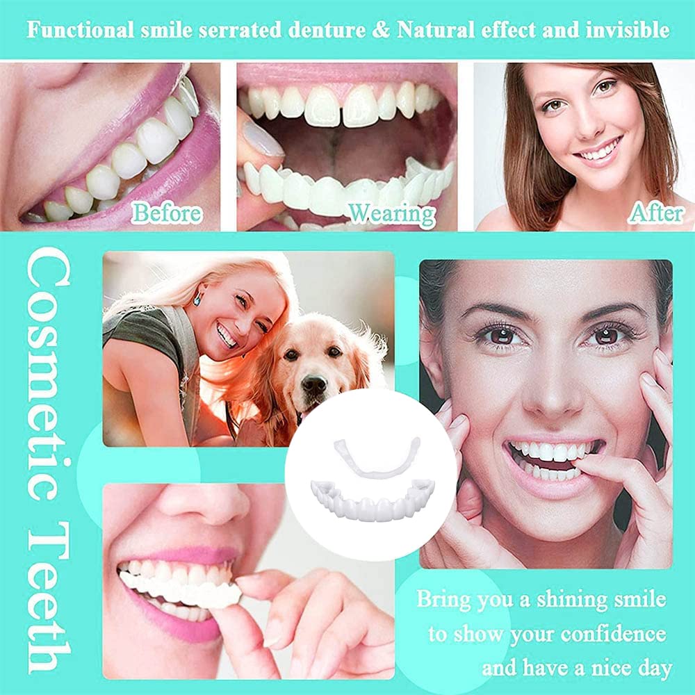 1Set Dentures Veneers Tooth,Dental Care Kits for Anti Molar Orthodontic Cosmetic Teeth,Smile Snap Tooth.(White,1Top+ 1Bottom+2Adhesives+1Tweezers+1Heart-Shaped Storage Box)