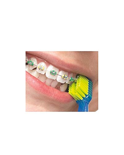 Curaprox Ortho Box - 5460 Ortho Toothbrush, Single Toothbrush, Interdental Toothbrush 07,14 & 18, Interdental Toothbrush Holder & Ortho Wax.