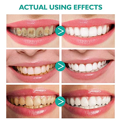 2 Pack Teeth Whitening Mousse - 2X 60ml Foam Whitening Toothpaste, Ultra-fine V-34 Mousse Foam Deeply Cleaning Gums, Stain Removal, Oral Care,Natural Mouth Wash Water