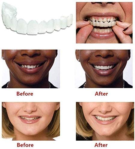 Dentures Fake Smile Teeth Moldable Customizable Temporary Top Teeth for Snap On Instant & Confidence Smile