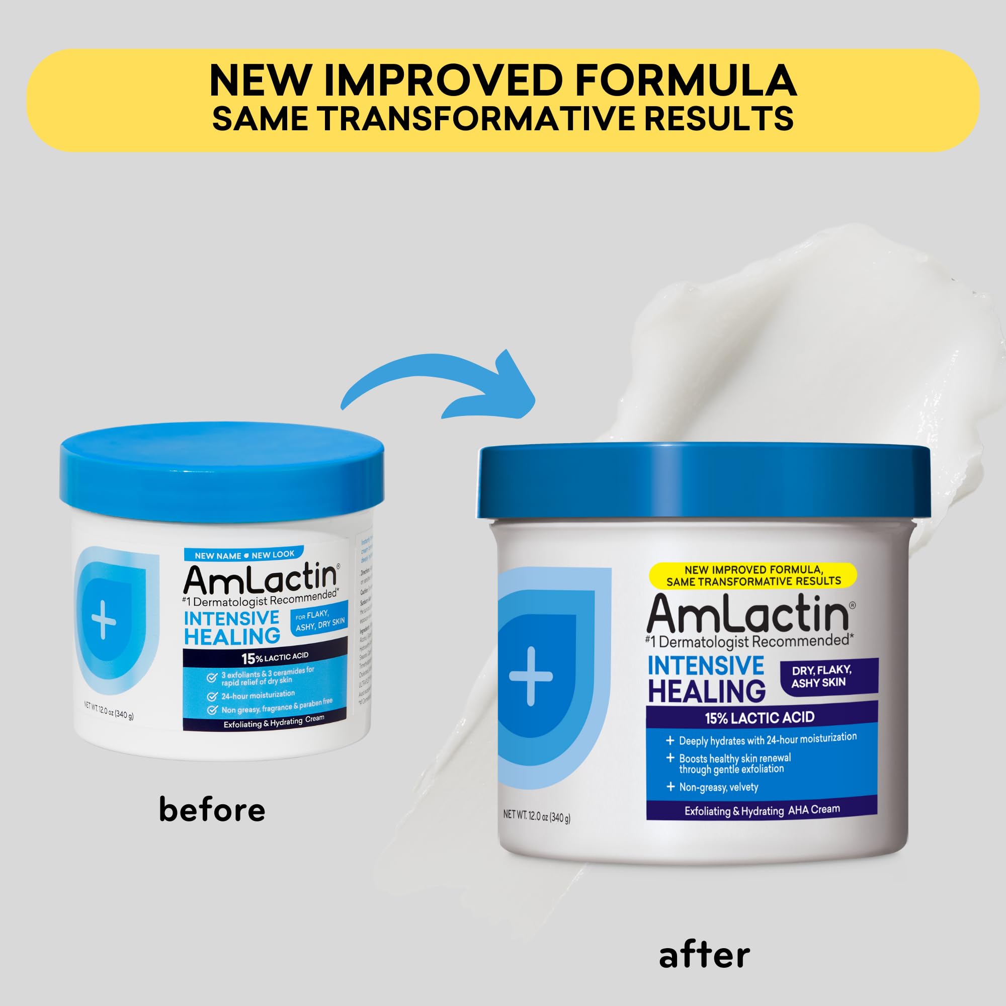 AmLactin Intensive Healing Body Cream, 12 oz Tub, 2-in-1 Exfoliator and Moisturizer for Dry Skin with 15% Lactic Acid and Ceramides for 24-Hour Moisturization