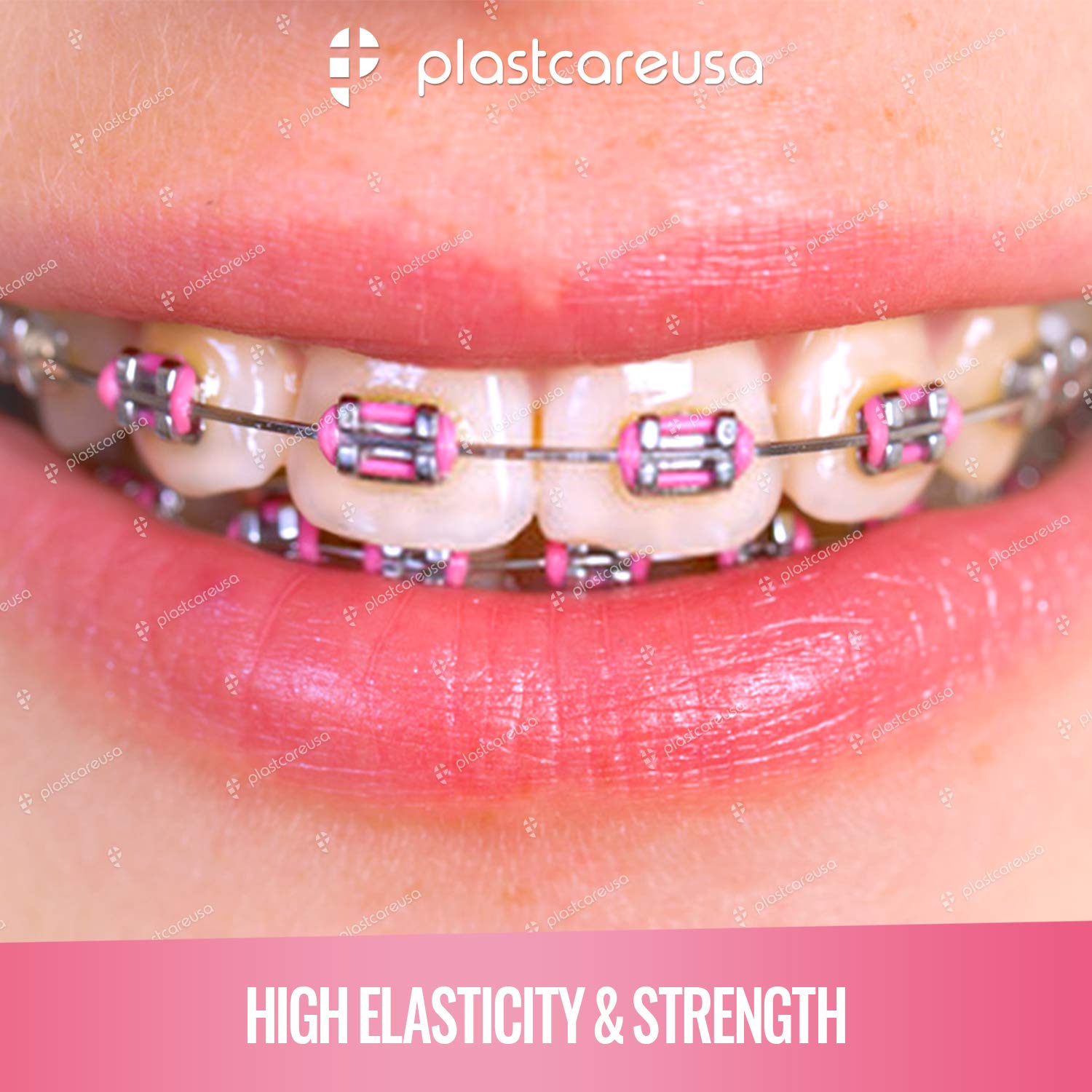 2080 Ligature Ties for Braces - Multicolor Dental Orthodontic Ligature Ties for Brackets - Elastic O-Ring Rubber Bands (2 Bags of 1040)