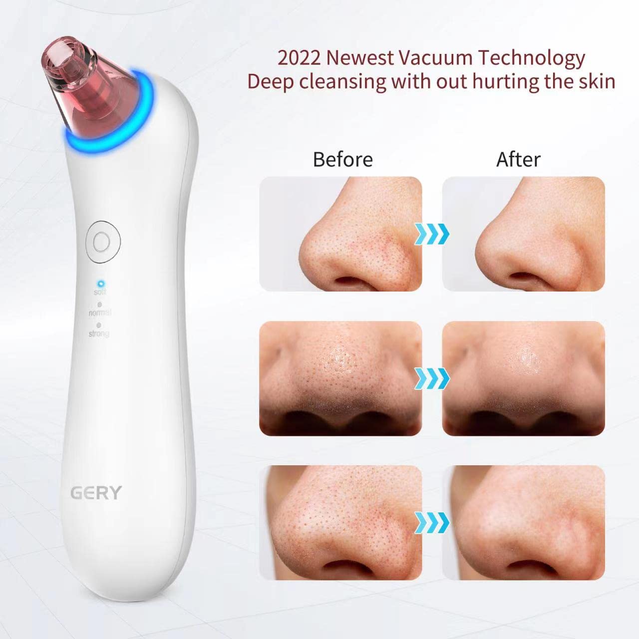Blackhead Remover Pore Vacuum Extractor-2025 Upgrade GERY Blackhead Cleaner Electric Comedone Acne Extractor Kit Facial and Nose Peel Whitehead Black Head Removal Tool,Red&Blue Light, and 4 Porbes