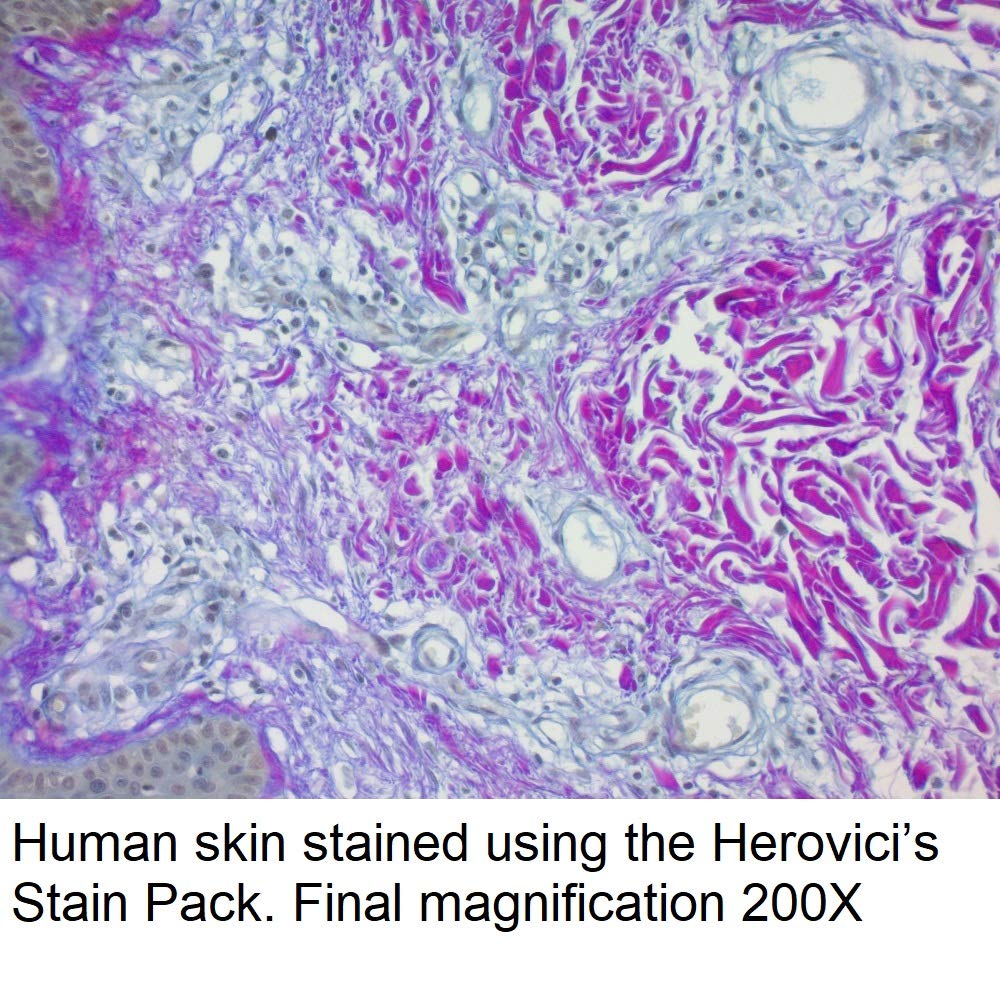 Herovici's Stain Pack, 500ml